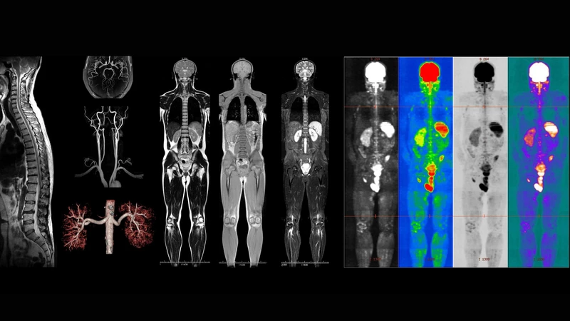 ĐỘT PHÁ CÔNG NGHỆ CHẨN ĐOÁN HÌNH ẢNH: "MẮT THẦN” MRI GIÚP TẦM SOÁT PHÁT ...