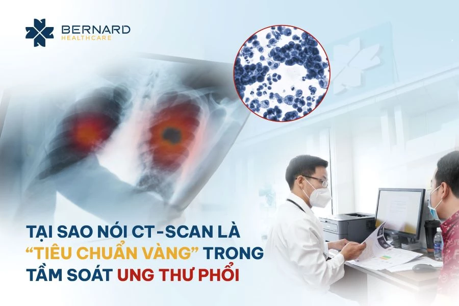 TẠI SAO NÓI CT-SCAN LÀ “TIÊU CHUẨN VÀNG” TRONG TẦM SOÁT UNG THƯ PHỔI