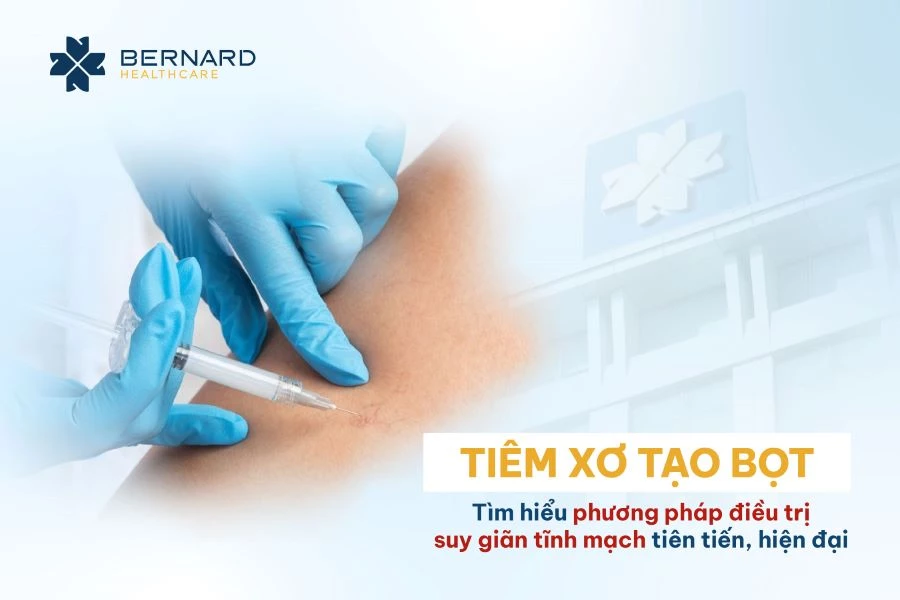 TIÊM XƠ TẠO BỌT: TÌM HIỂU PHƯƠNG PHÁP ĐIỀU TRỊ SUY GIÃN TĨNH MẠCH TIÊN TIẾN, HIỆN ĐẠI