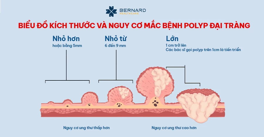 POLYP ĐẠI TRÀNG VÀ NGUY CƠ TIẾN TRIỂN THÀNH UNG THƯ: ĐỪNG BỎ LỠ GIAI ...